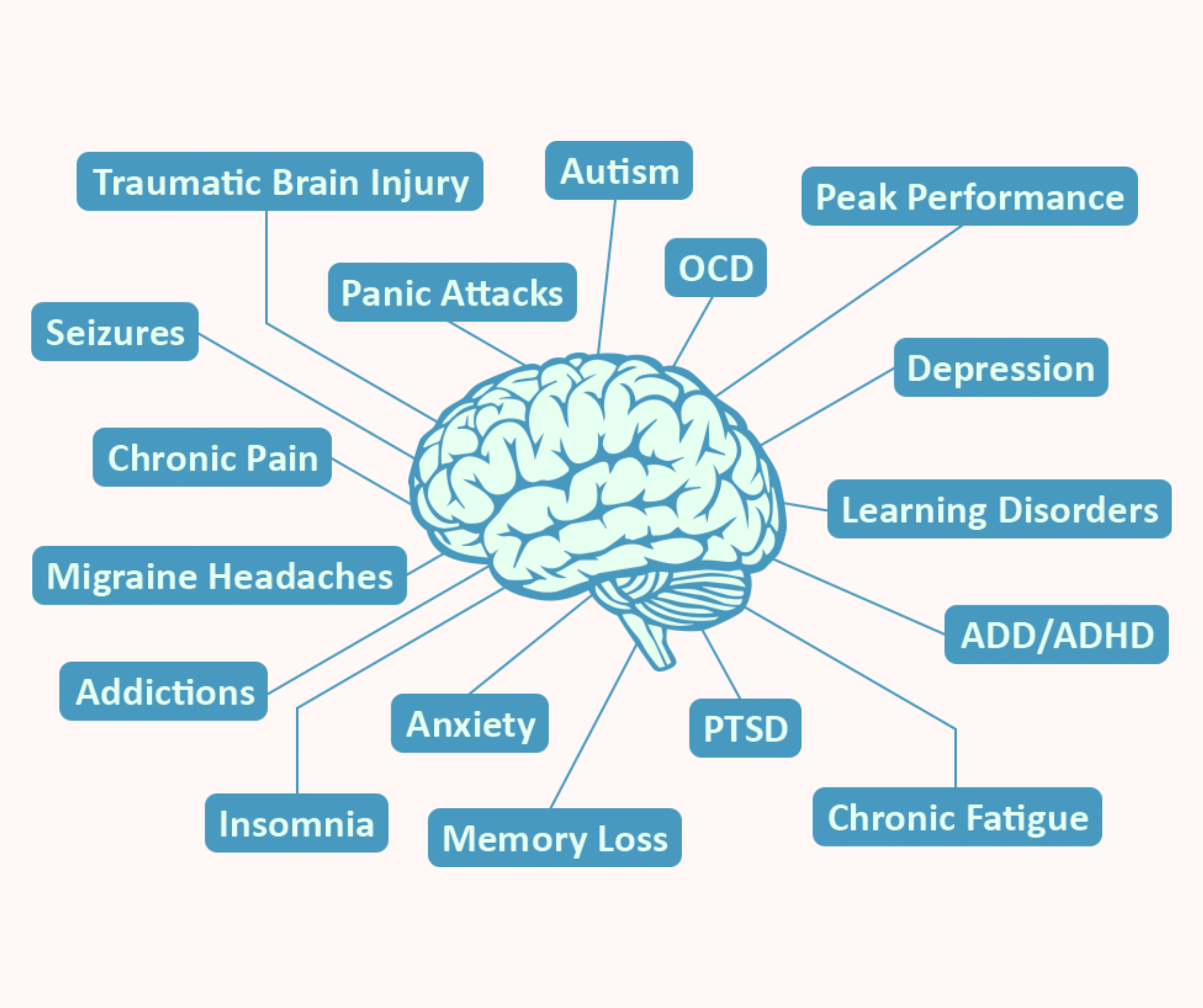 Neurofeedback - Serenity Therapeutics