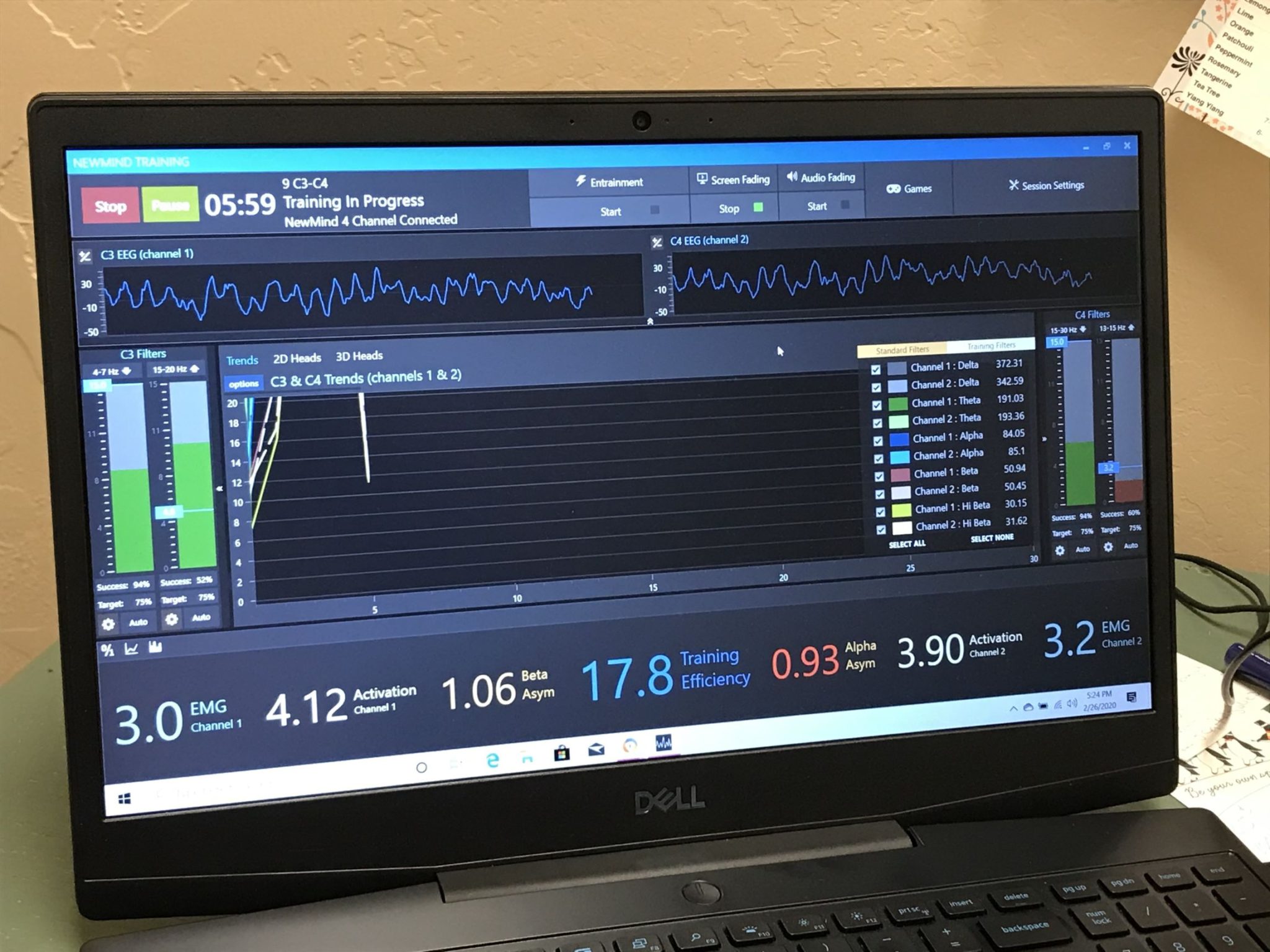 Neurofeedback for Autism and ADHD - Serenity Therapeutics